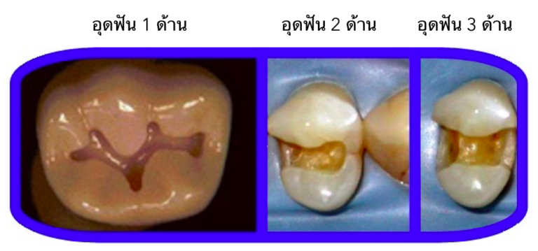 บทความ ทันตกรรมทั่วไป Smile Loft Dental Clinic